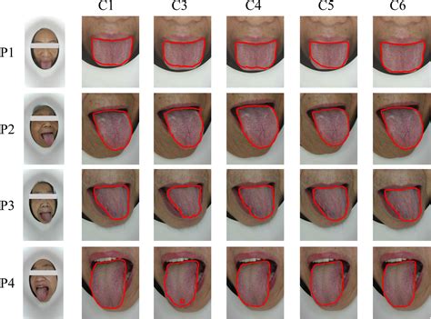 Raff Net An Improved Tongue Segmentation Algorithm Based On Residual Attention Network And