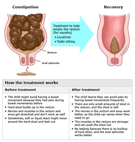 Fecal Incontinence