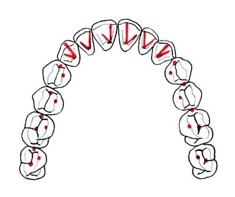 How Does The Occlusal Plane Relate To The Anterior Teeth The Dawson