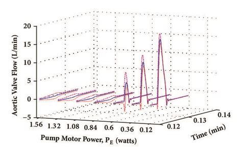 Hemodynamic Waveforms Of Aortic Valve Flow In The Presence Of