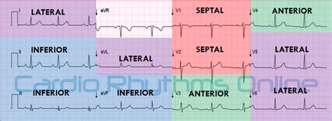 Cvt Mohd Farid Ecg And Echocardiography Case Study Chronic Myocardial