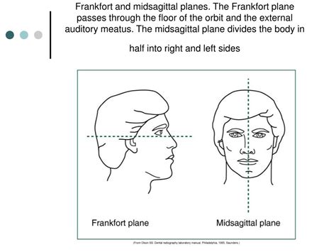 Ppt Panoramic Radiography Powerpoint Presentation Free Download Id