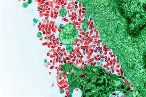 Two Rabies Researchers Explain How To Protect Yourself Against The Disease