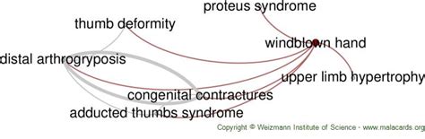 Windblown Hand Disease Malacards Research Articles Drugs Genes