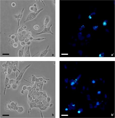 Phase Contrast Micrographs A B And Fluorescence Micrographs Of