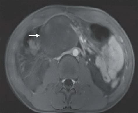 Duodenal Injury Radiology Key