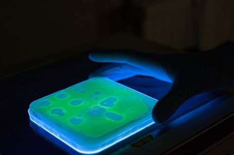 Studentship Opportunity On Fungal Sex Hormones Only A Few Days Left