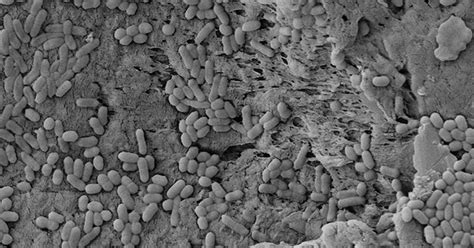 ¿qué Es La Bacteria Listeria Que La Cofepris Alertó Infobae