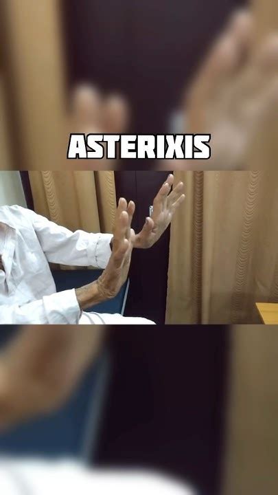 Asterixis Youtube