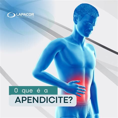 O Que é A Apendicite Lapacor