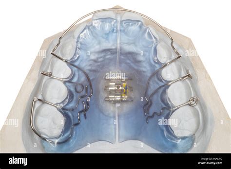 Isolated Teeth Dentist Pine Tooth Tooth Space Bracket Caries