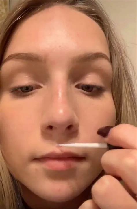 Women Super Glue Their Top Lips To Their Face For ‘glued Lip Challenge