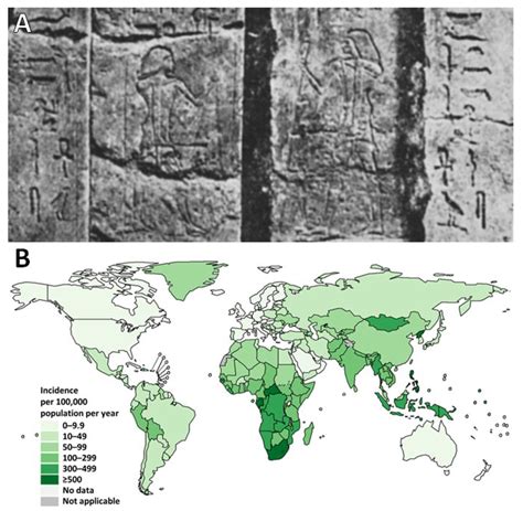 Evolution Of The Different Clinical Stages Of Tuberculosis Tb From Download Scientific