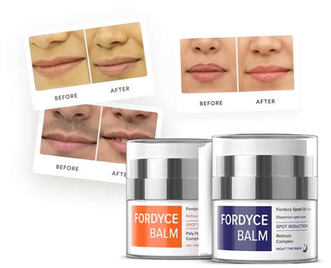 Remove Fordyce Spots On Lips