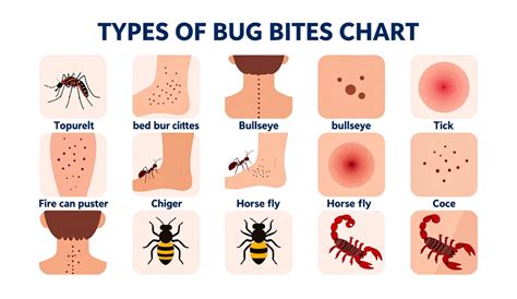 Types Of Bug Bites Chart Explained Pictures Symptoms And Treatment Guide