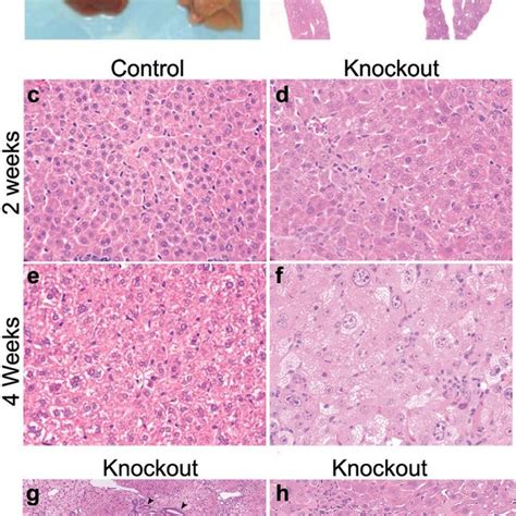 A Liver Morphology Of Wild Type And Knockout Mice Photo Shows Livers