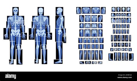 Set Of X Ray Skeleton Human Body Hands Legs Chests Heads Vertebra