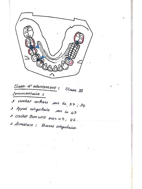 TracÉ Des Chassis Papm 230407 112455 1 Pdf