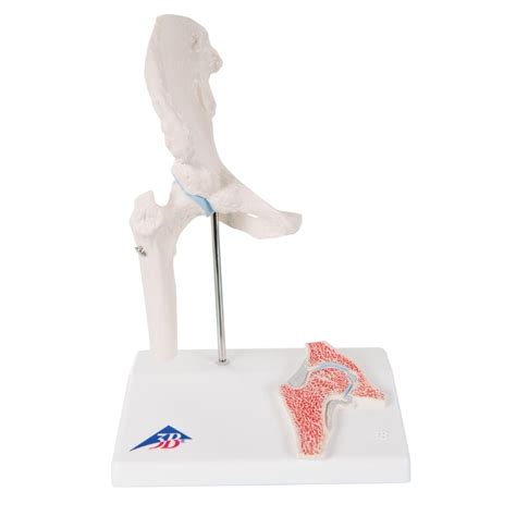 Anatomical Mini Hip Joint With Cross Section Model