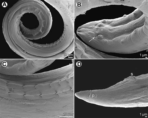 Redescriptions Of Spinitectus Acipenseri And S Micracanthus Nematoda