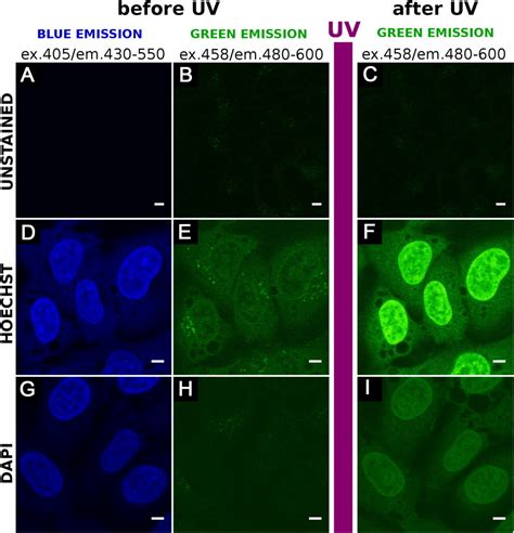Hoechst Dapi Staining At Sarah Alanson Blog