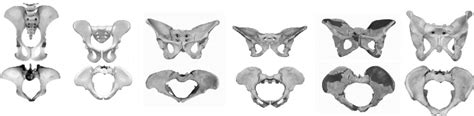 Photographs Showing The Evolution Of The Shape And Orientation Of The