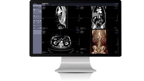 3d Radiology Solution Infinitt Infinitteurope