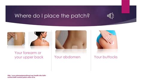 The Contraceptive Patch Real Presentation Youtube