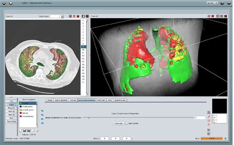Segmentation Of The Lung Tissue Using Yadiv A Lung Tissue Analysis ” Download Scientific