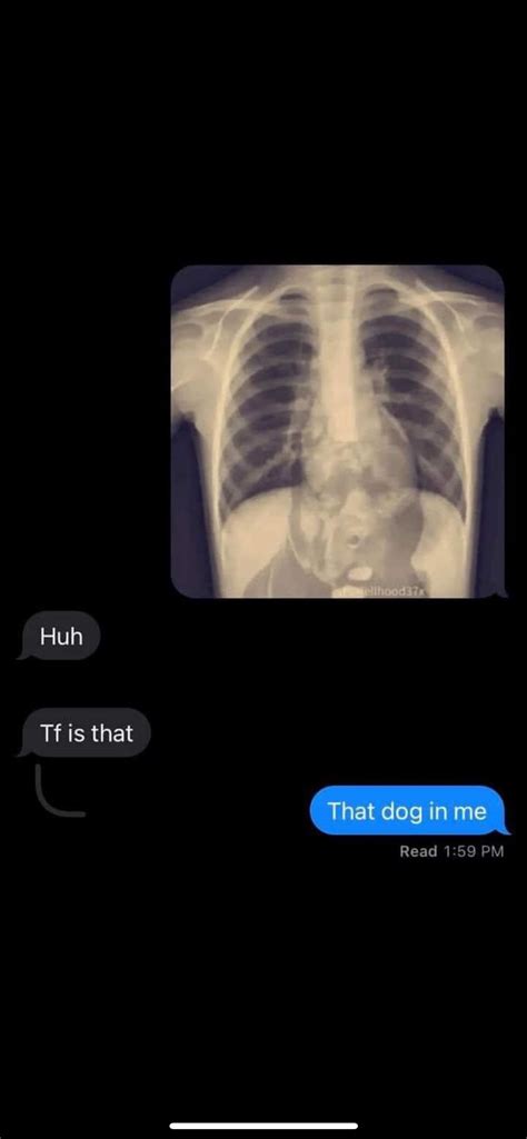 Guys My X Ray Results Came Back Im Not Sure I Have The Words To Explain How I Feel About The