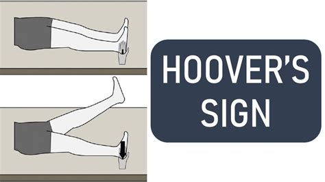 Hoovers Sign Hoover Test Youtube