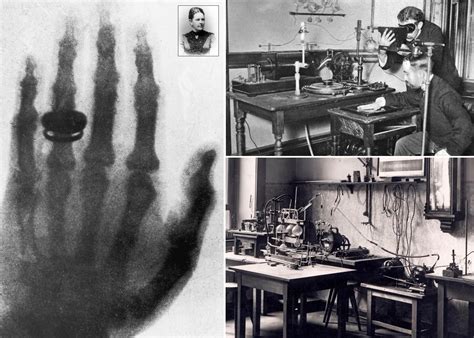 William Roentgen X Ray Roentgen X Rays Dcrz