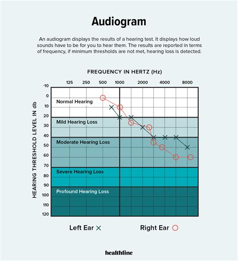 What Is An Audiogram Understanding Hearing Test Results