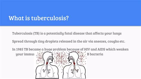 Turberculosis Pptx