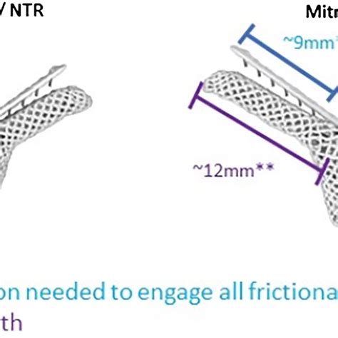 The Difference Between The Commercially Available Mitraclip Devices