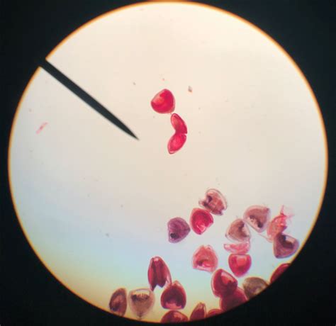 Phylum Mollusca Lab Flashcards Quizlet