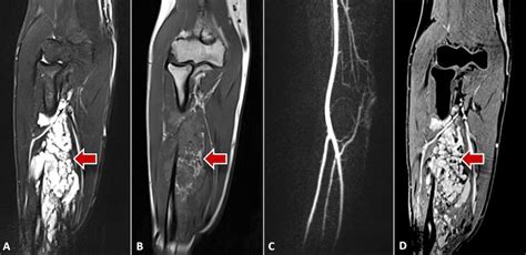 Compva Magnetic Resonance Imaging
