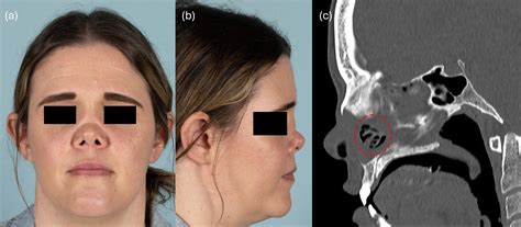Laryngoscope Investigative Otolaryngology Wiley Online Library