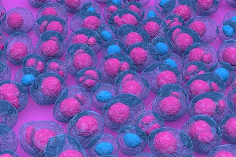 Multiple Myeloma Illustration Stock Image F0385815 Science Photo Library