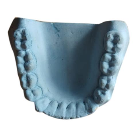 Dental Plaster Price At Ellis Shepherd Blog
