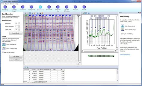 1d And 2d Gel Analysis Software At ₹ 66000 Image Analysis Software In