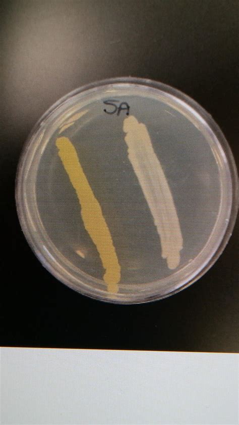 Solved I Grew This Mannitol On Msa Plate Is This