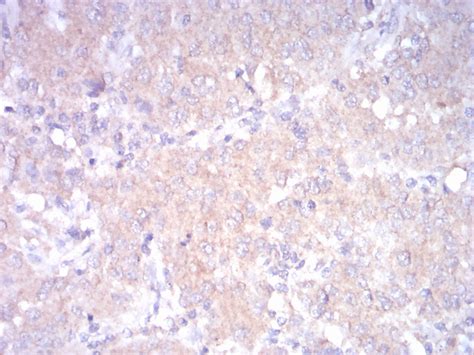 Ldlr Antibody Purified Mouse Monoclonal Antibody Wb Ihc Fc E Buy Now Abcepta