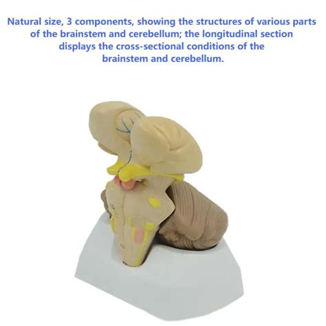 Human Fourth Ventricle Choroid Plexus Anatomical Model Medical