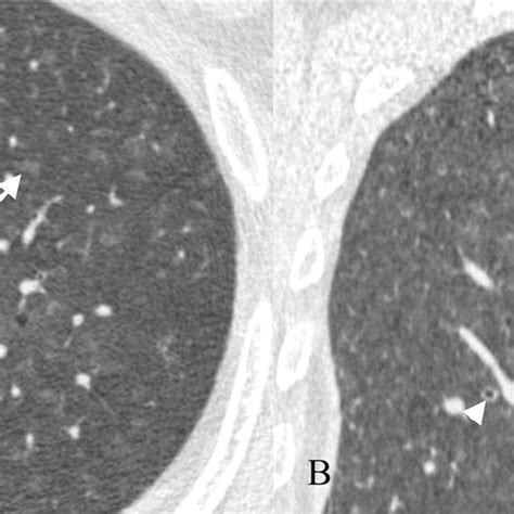 Pattern Inconsistent With Uip Inconsistent With Uip Patterns In