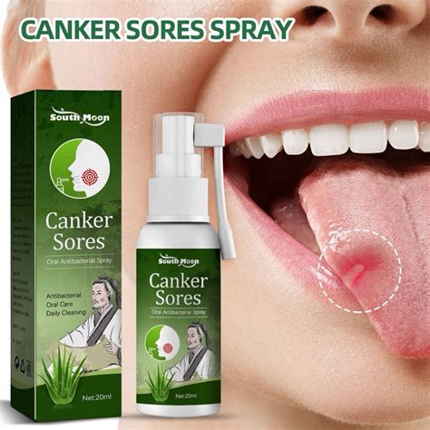 South Moon Spray Ulser Penjagaan Mulut Penjagaan Mulut Lidah Ulser Pembersih Mulut Terapi