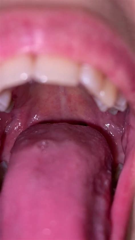 Super Beautiful Close Up Of Mouth And Uvula