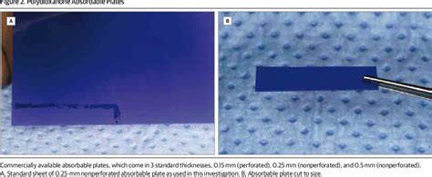 Figure 2 From The Effect Of Polydioxanone Absorbable Plates In