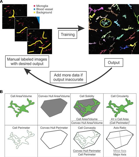 3 Dimensional Morphological Characterization Of Neuroretinal Microglia In Alzheimers Disease