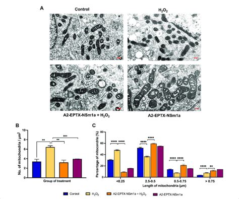 Observation Of Mitochondrial Morphology From Electron Microscope A